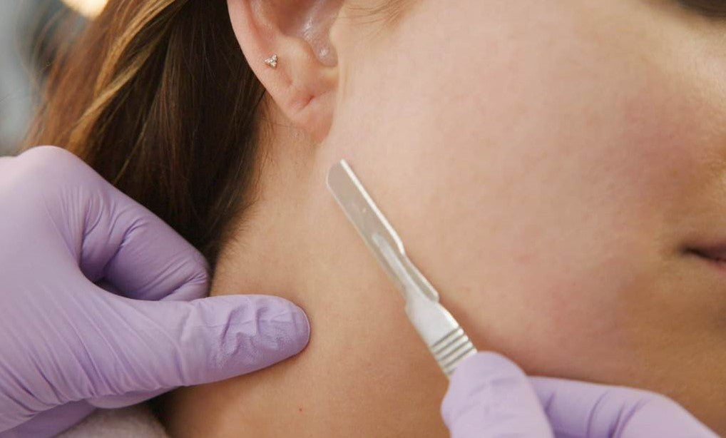 Dermaplane – Spa361 at The Dermatology and Skin Cancer Institute